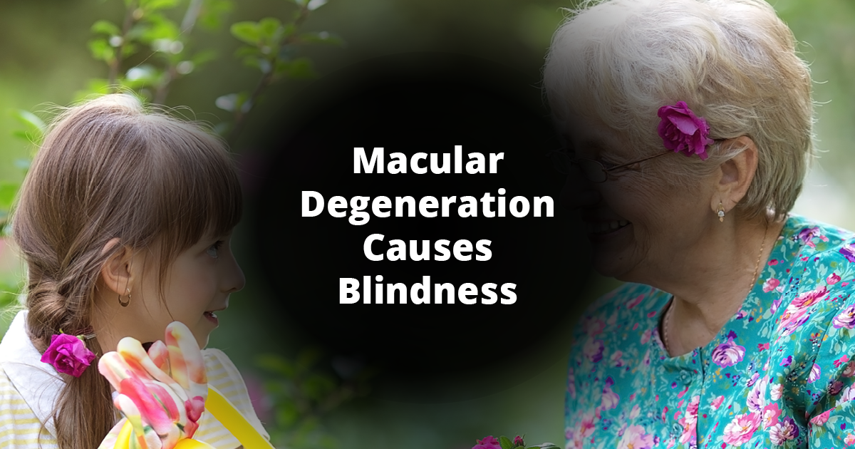 Macular Degeneration Week - The Beast